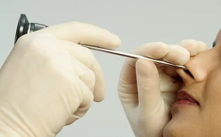 Videoendoscopia nasosinusal – Centro Otorrino BH